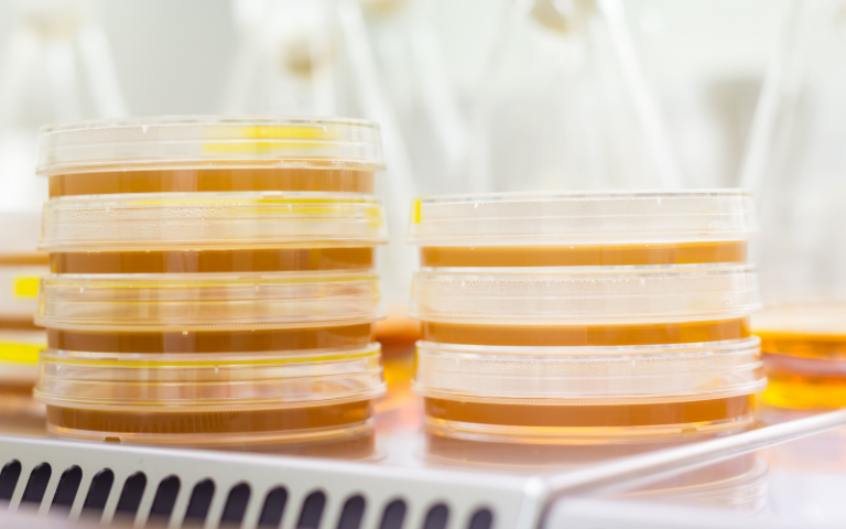 Late-Breaking Data for Cytovale’s Sepsis Test - NetScientific